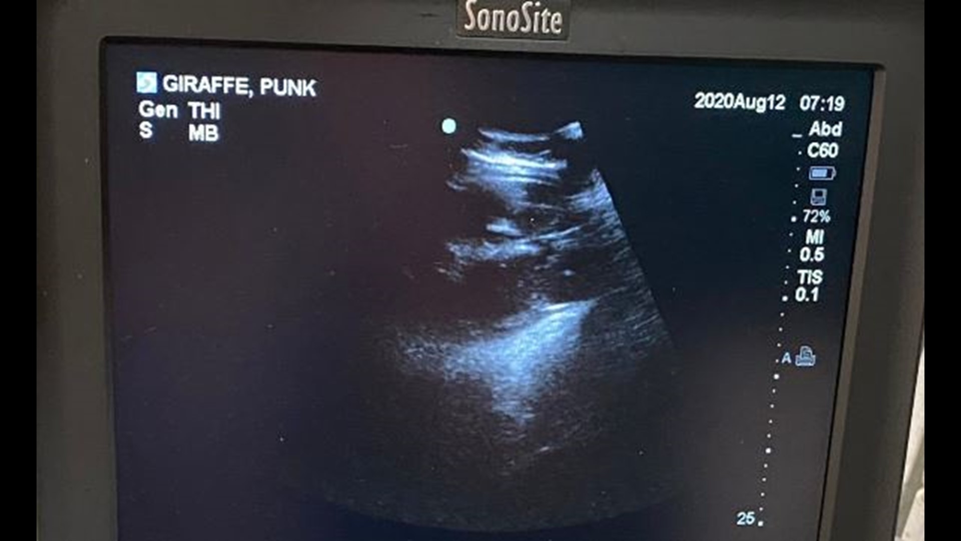 Two giraffe pregnancies confirmed at Abilene Zoo | myfoxzone.com