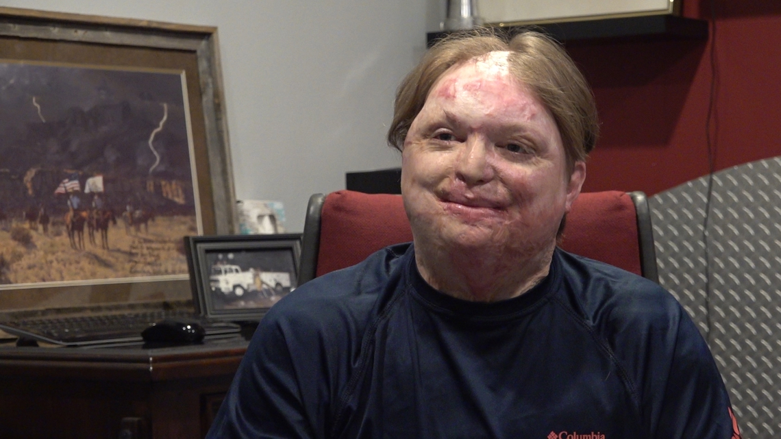 Annual golf tournament to support nonprofit for burn victims ...